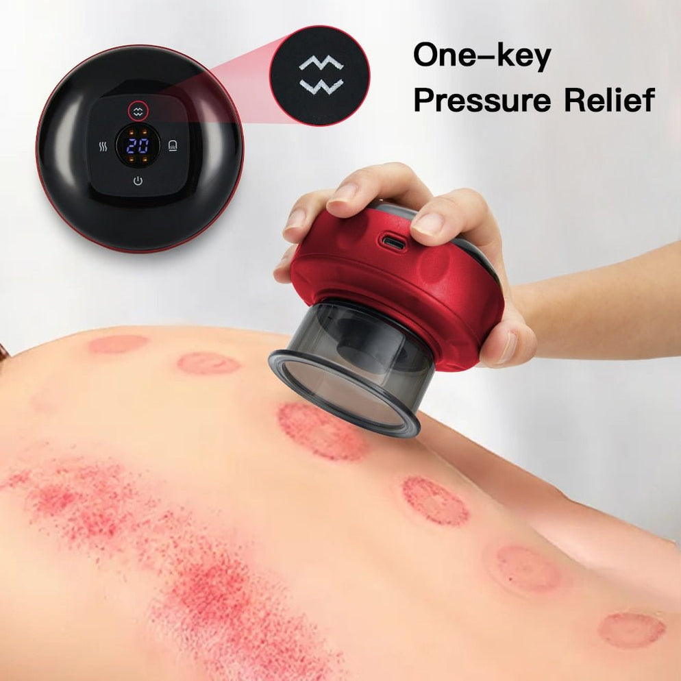 ProSuction Electric Cupping Set — Flamin' Fitness